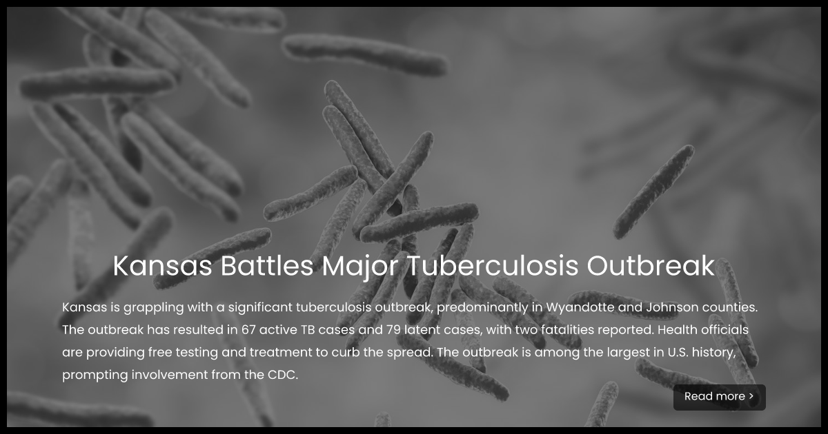Kansas Battles Major Tuberculosis Outbreak | Trendy.so